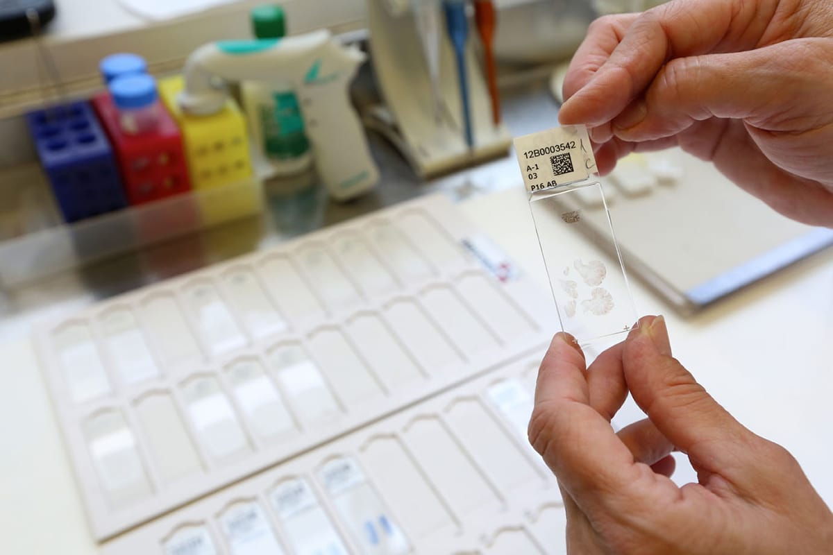 Primary endocrine treatment, a new approach for patients with breast ...